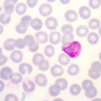 What Are The Symptoms Of Malaria? - Superdrug Health Clinic